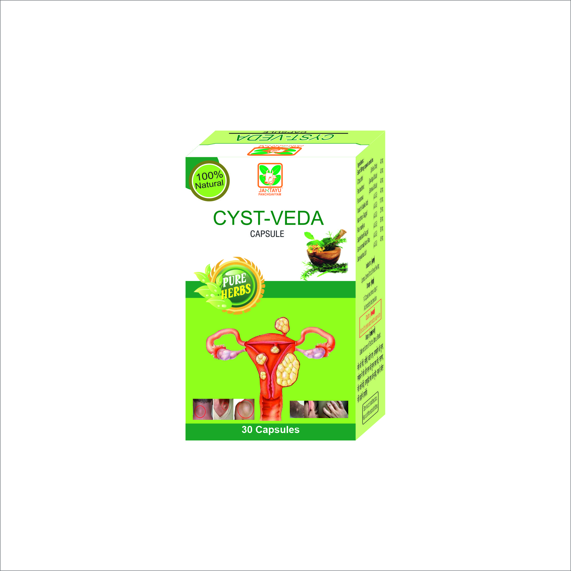 Jantayu's CYST Veda Capsule - JANTAYU AYURVEDA