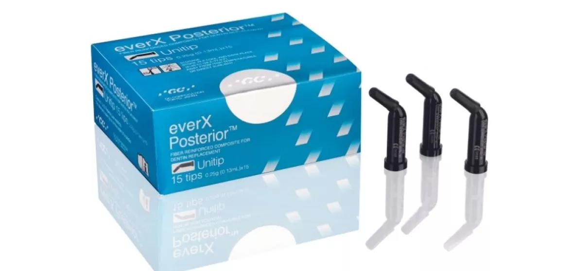 GC everX Posterior Fibre-Reinforced Composite for Dentin Replacement ...