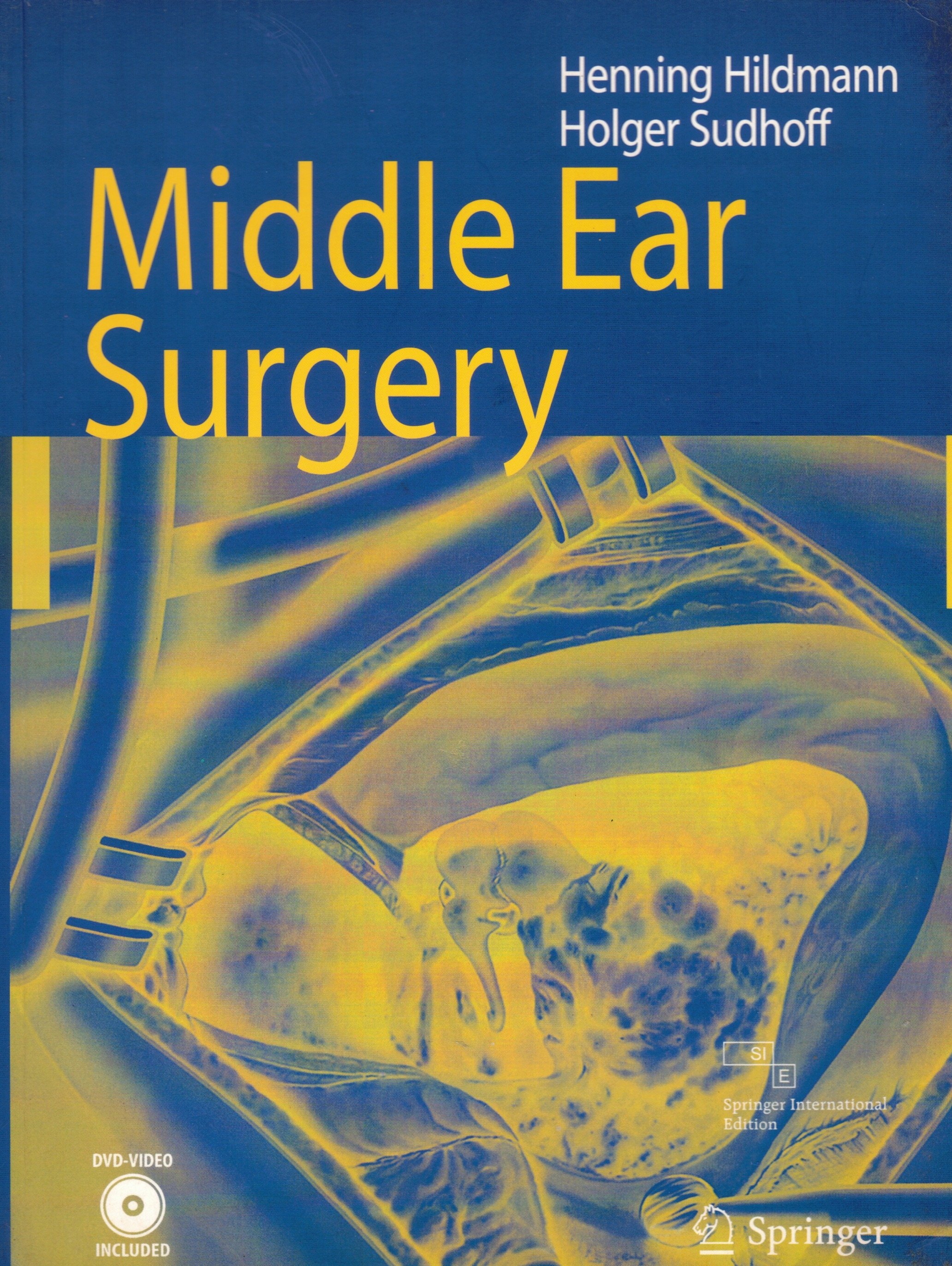 Middle Ear Surgery by Henning Hildmann, Holger Sudhoff