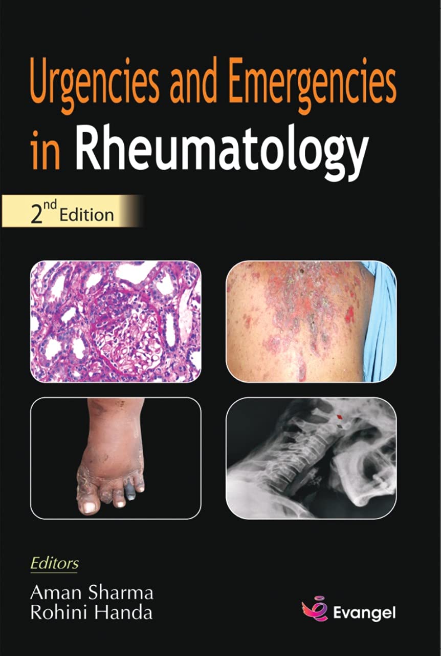 Urgencies and Emergencies in Rheumatology 2nd Edition, 2021