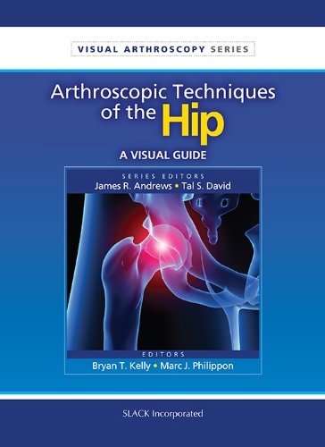 Arthroscopic Techniques of the Hip: A Visual Guide (Visual Arthroscopy)